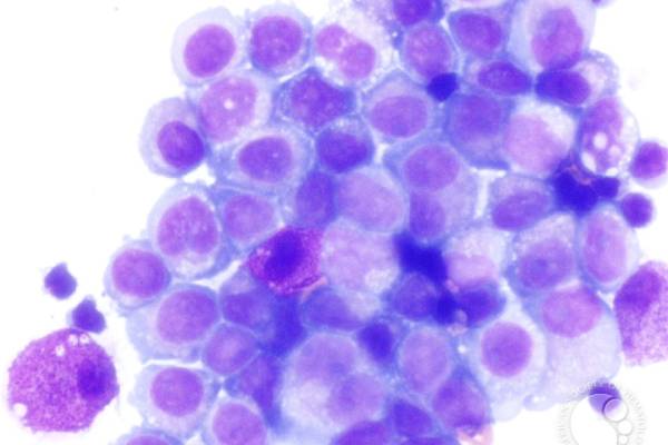 Pathology & Lab Services – Devgiri Memorial Hospital